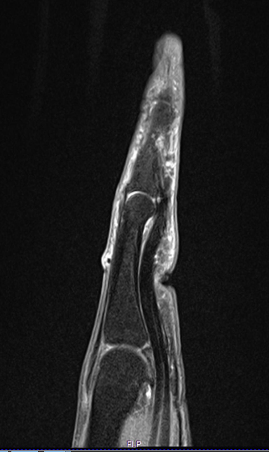 Schnellender Finger » Ordination Url | Dr. Robert Url