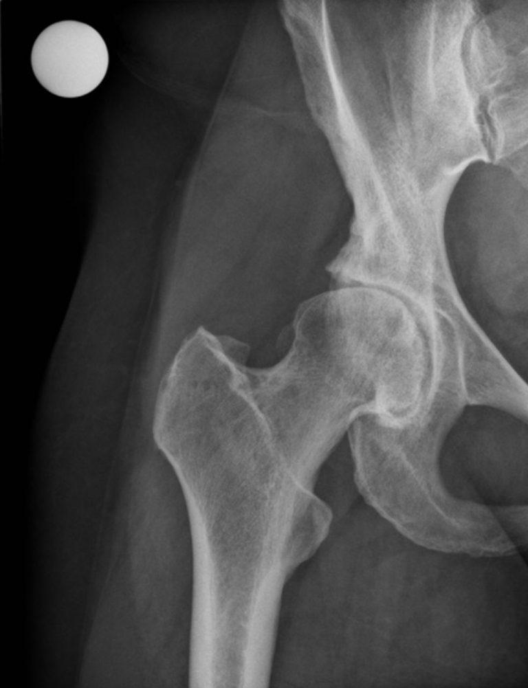 Hüftgelenksarthrose » Ordination Url | Orthopäde Dr. Robert Url